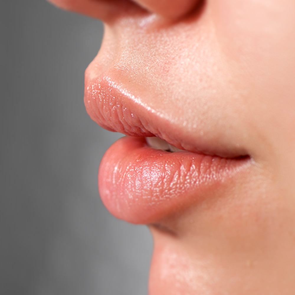 Botox Lip Flip – Bloom Health